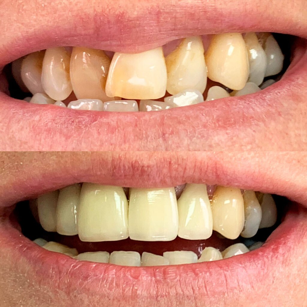 Rehabilitación Oral, Restauración Dental | DentArt